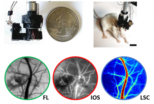 Projects – Neuroengineering & Biomedical Instrumentation Lab